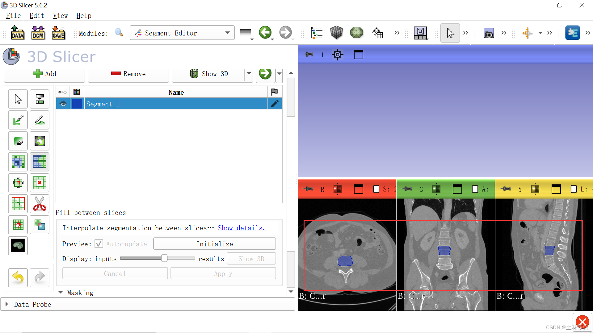 3D Slicer的学习（二） 图像的分割_3dslicer裁剪-CSDN博客