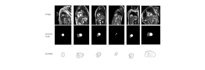 医学图像分割方向优质的论文及其代码【Medical Image Segmentation】UNet、transformer、计算机视觉_医学图像处理论文及代码实现-CSDN博客
