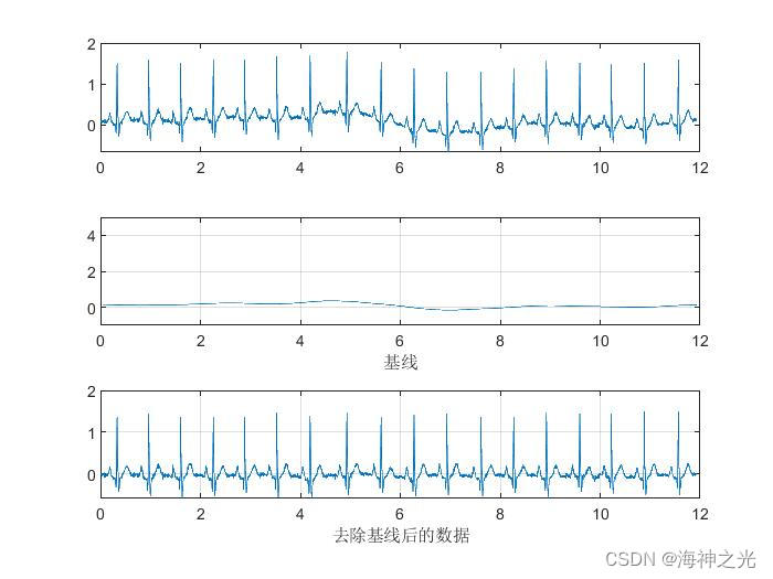 【心电信号ECG】心电信号P,Q,R,S,T波位置标记（读取人体心跳数据）【含Matlab源码 4344期】_ecg pqrst-CSDN博客
