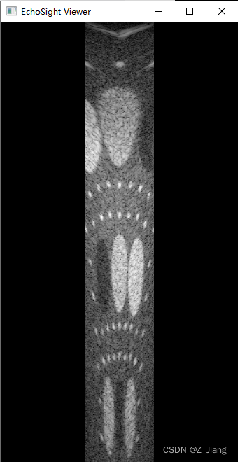 彩超框架EchoSight开发日志记录-CSDN博客