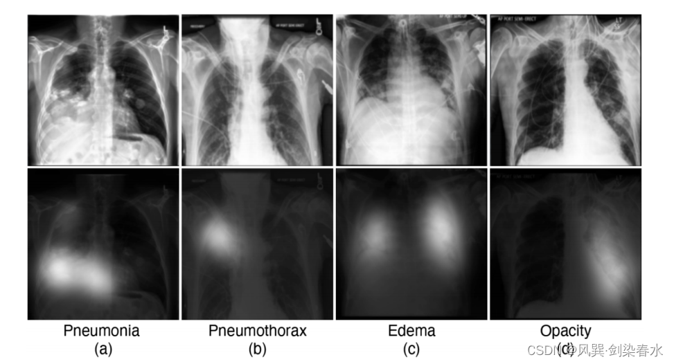 【CLIP综述】CLIP在医学影像中的应用（一）_pmc-clip-CSDN博客