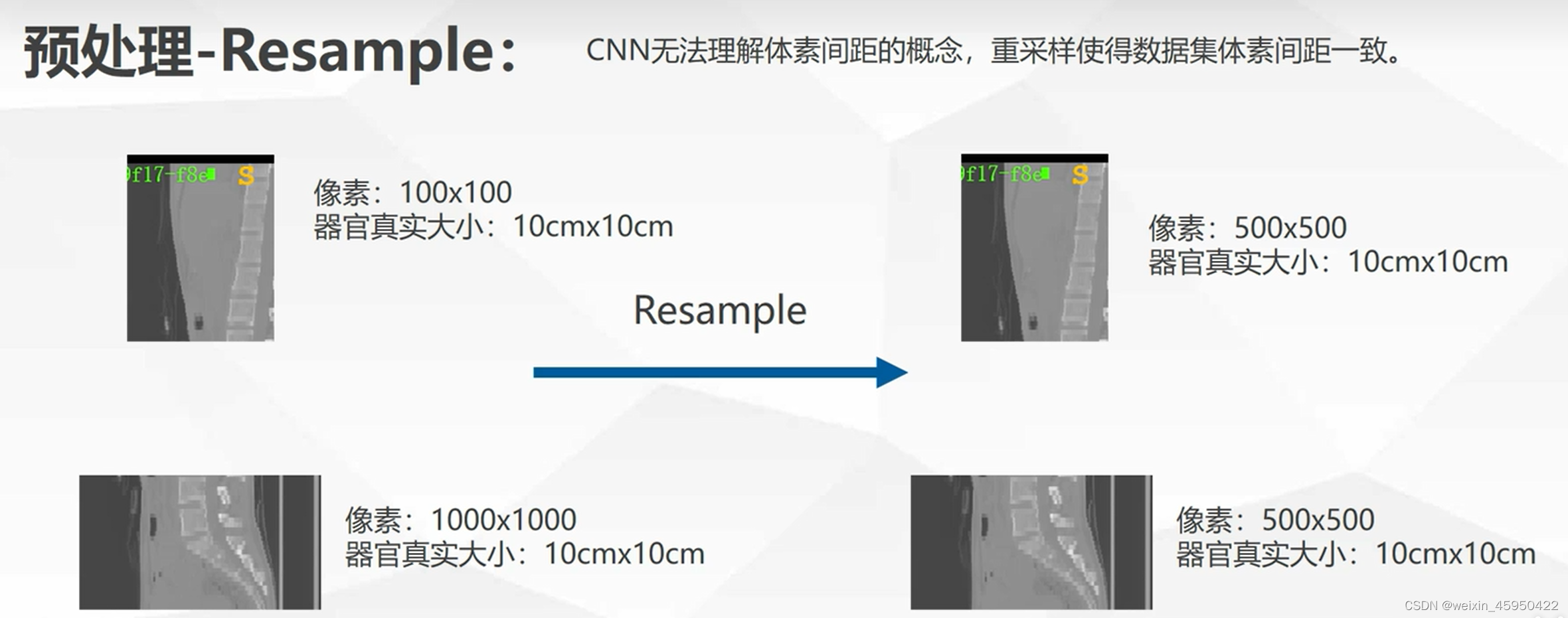 nnunet笔记_cascade unet-CSDN博客