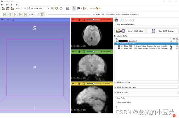 3D Slicer打开 fMRI 影像并查看扫描参数_fmri查看属性-CSDN博客