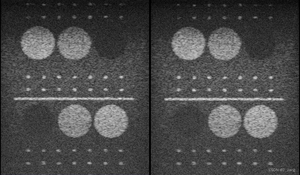 彩超框架EchoSight开发日志记录-CSDN博客