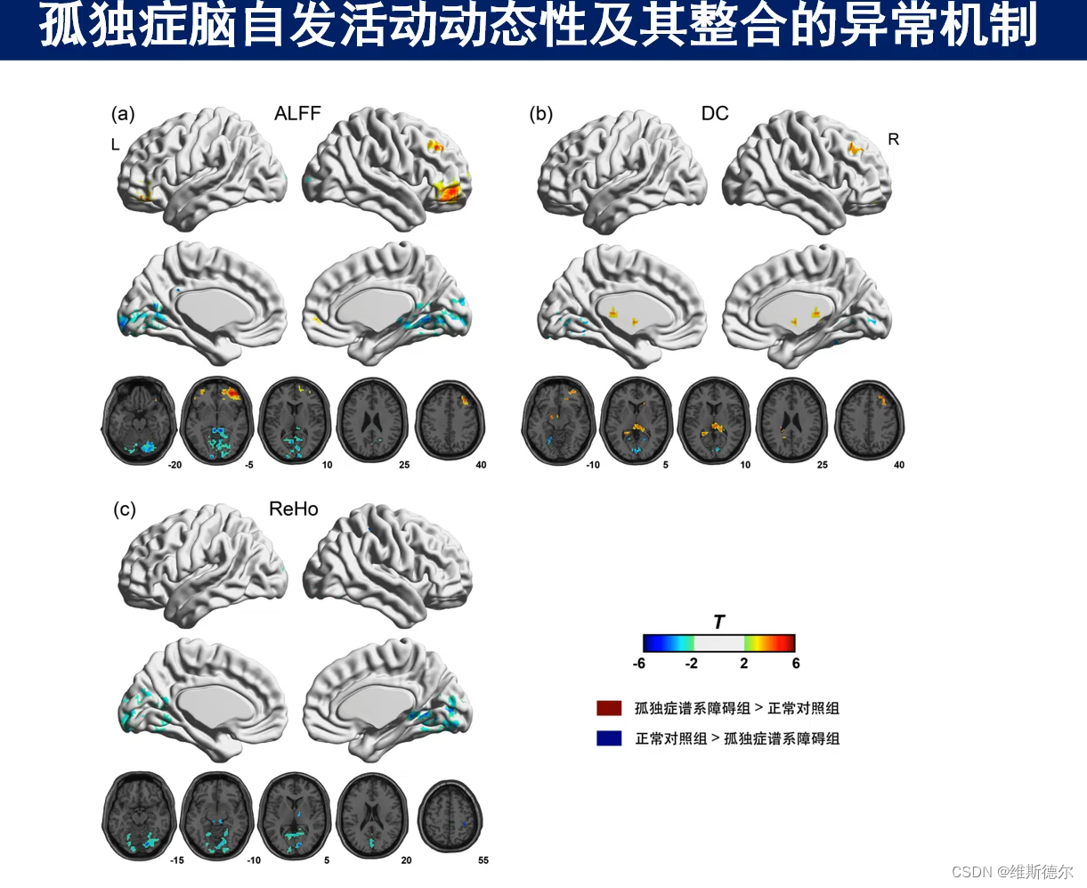 静息态功能磁共振成像(rs-fMRI)原理与数据分析——2_nilearn分析rs-fmri-CSDN博客