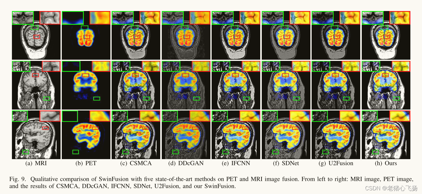 读论文：SwinFusion: Cross-domain Long-range Learning for General Image ...
