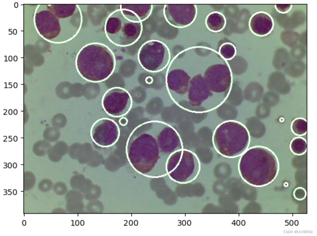 医学图像处理-目标检测与分割_opencv医学-CSDN博客