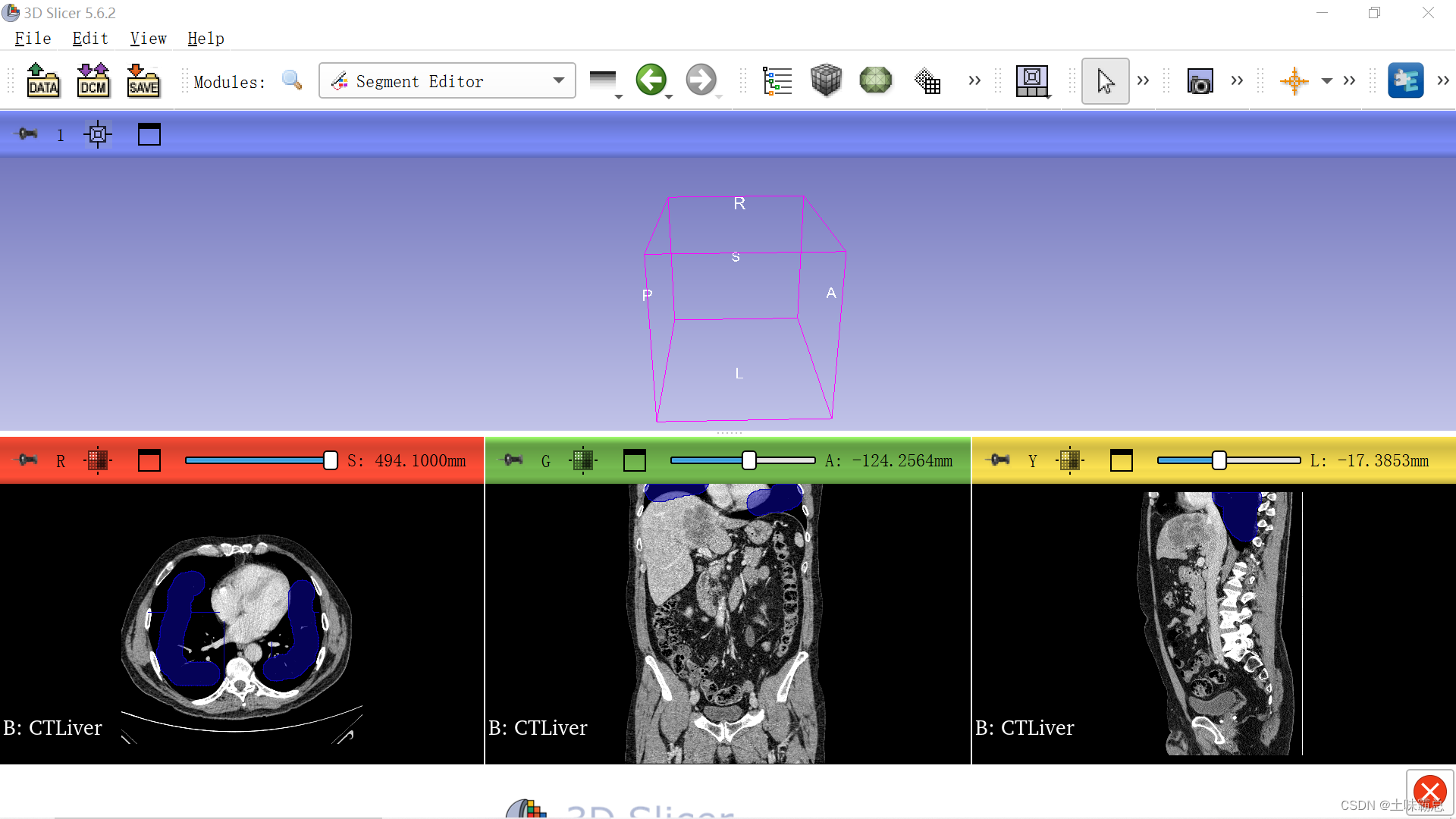 3D Slicer的学习（二） 图像的分割_3dslicer 用mask作用于图像 生成新图像-CSDN博客