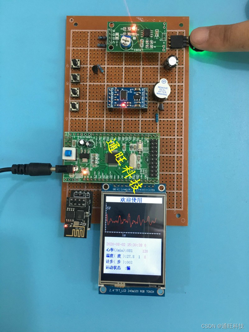 基于stm32单片机手环心率曲线心电图体温计步器检无线云平台设计130基于stm32的心率血压手表说明书 Csdn博客 1414