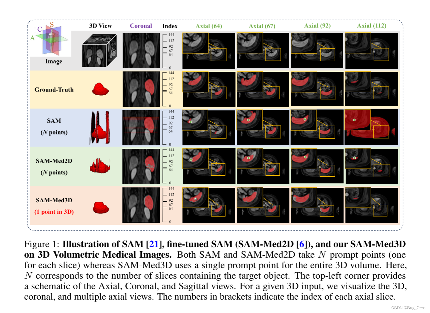 SAM-Med3D论文阅读笔记-CSDN博客