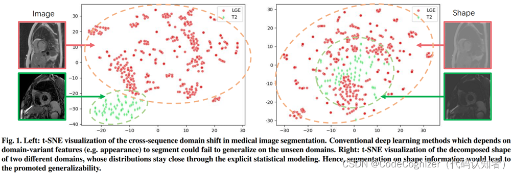 MIA | BayeSeg: Bayesian Modeling for Medical Image Segmentation with Interpretable ...