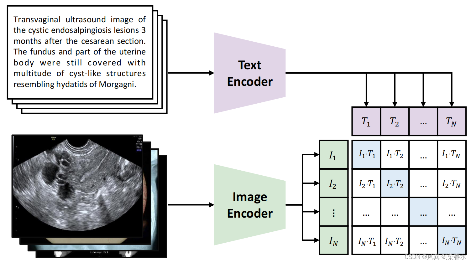 【CLIP综述】CLIP在医学影像中的应用（一）_pmc-clip-CSDN博客