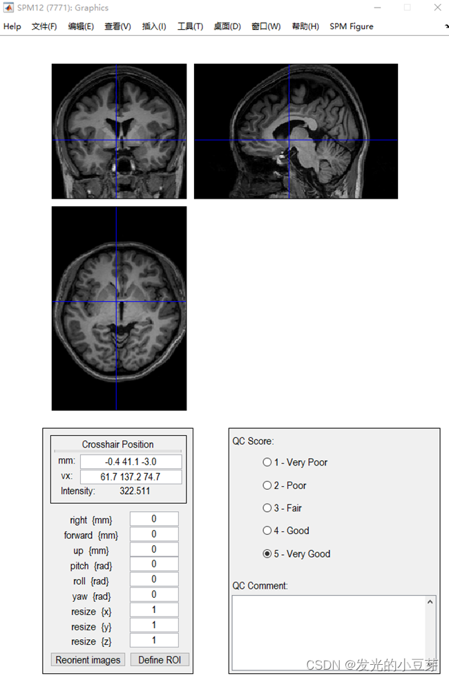 基于DemoData的DPABI首次运行及SPM安装_dpabi 安装-CSDN博客