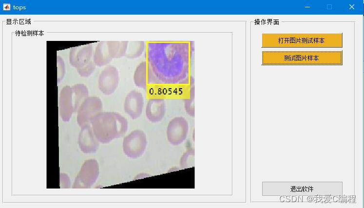 m基于yolov2深度学习的细胞检测系统matlab仿真,带GUI操作界面-CSDN博客
