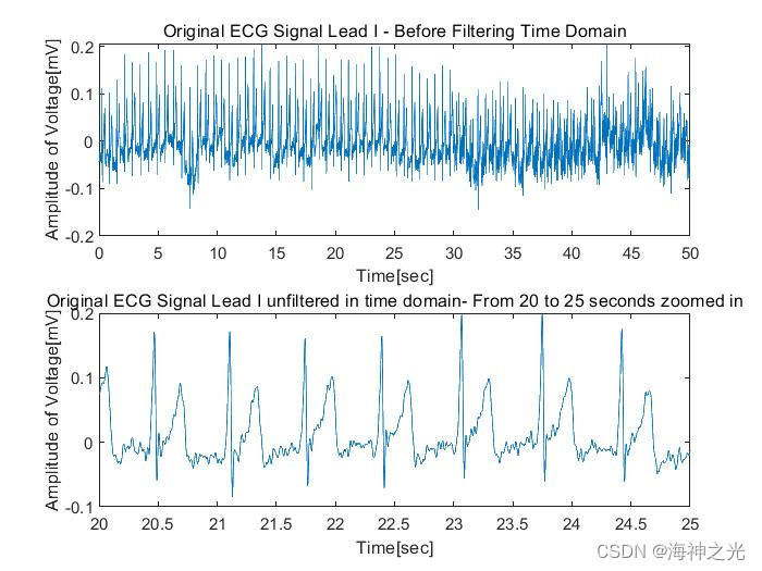 【心电信号ECG】心电信号处理（时域频域滤波 QRS检测 心率检测）【含Matlab源码 4306期】_心电信号处理系统设计-CSDN博客