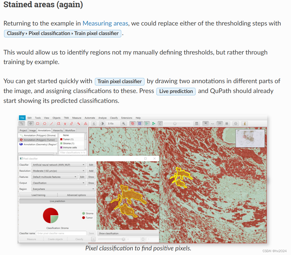 图像识别SLIC、Haralick texture features（qupath过时）_haralick纹理特征 matlab-CSDN博客