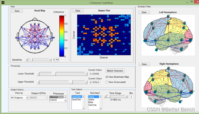 脑研究、脑网络分析、可视化的工具箱有哪些？_脑网络工具箱-CSDN博客