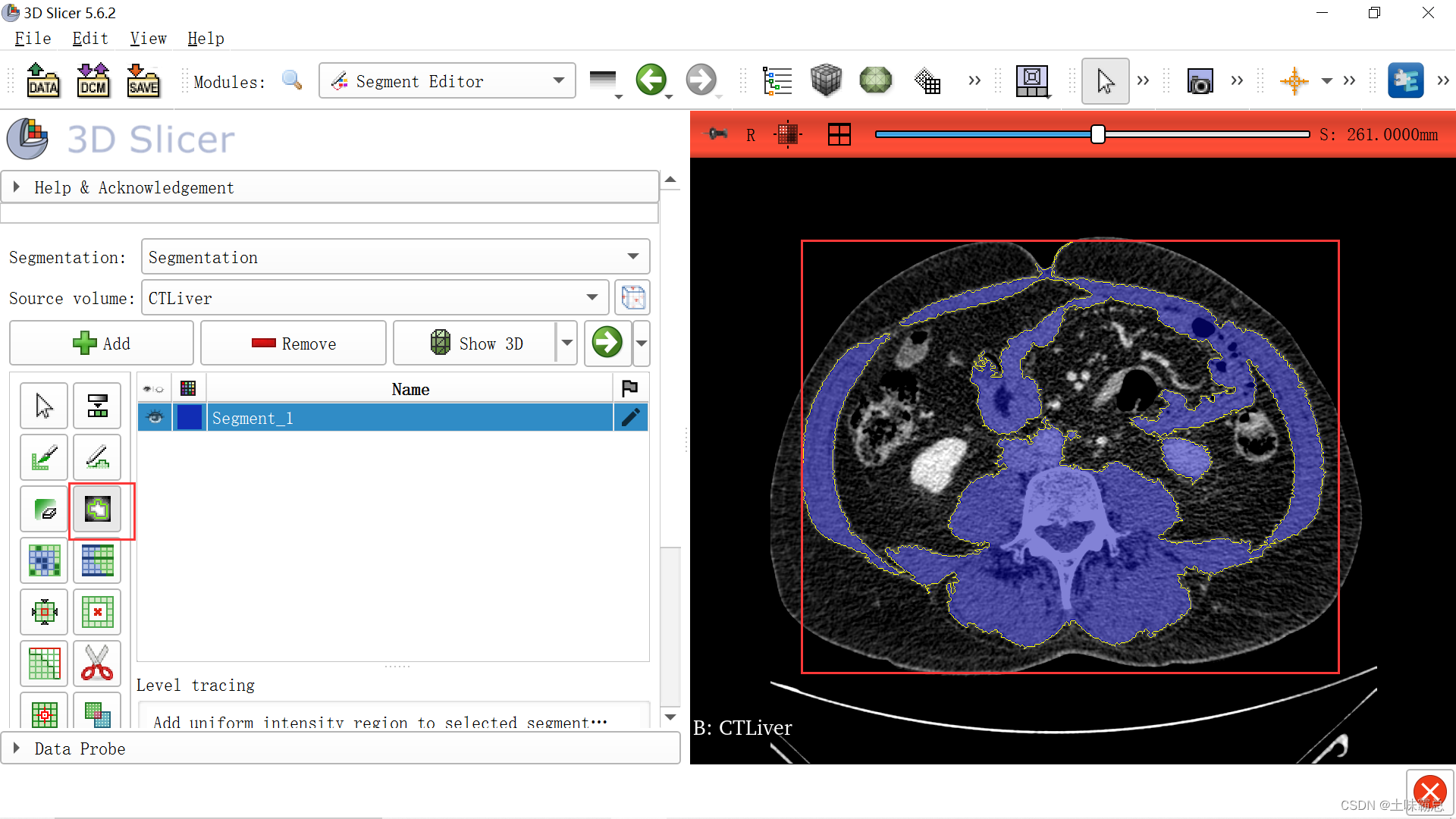 3D Slicer的学习（二） 图像的分割_3dslicer裁剪-CSDN博客