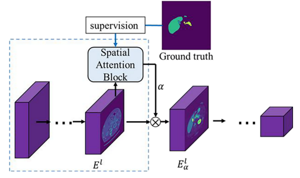 【论文阅读笔记】Multi-organ segmentation network for abdominal CT images based on spatial attention and ...
