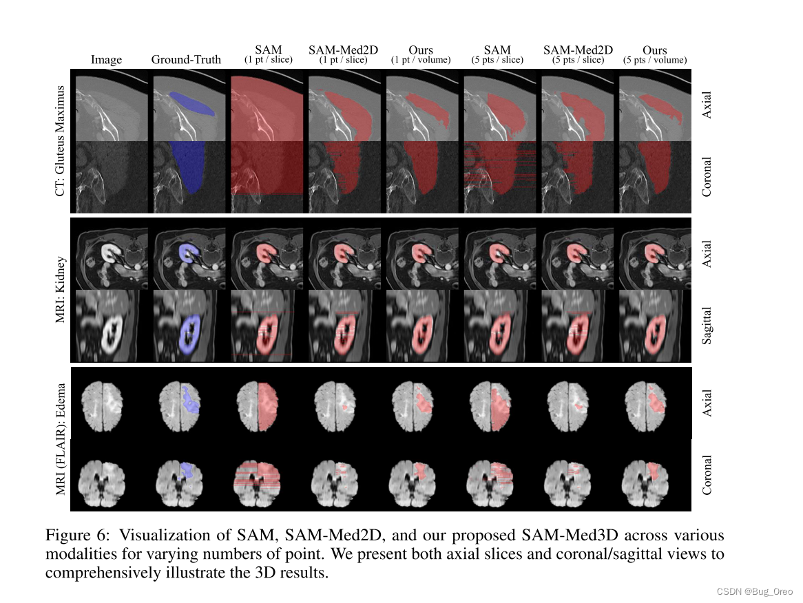 SAM-Med3D论文阅读笔记-CSDN博客