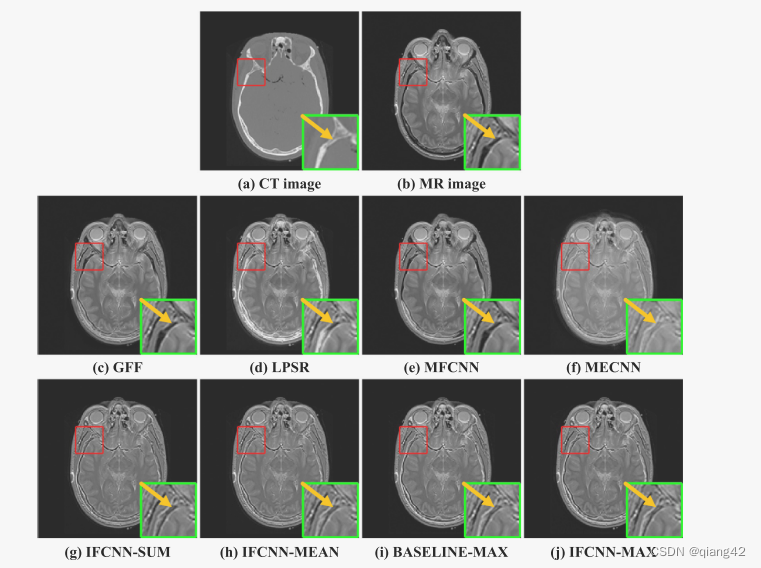图像融合论文阅读：IFCNN: A general image fusion framework based on convolutional ...