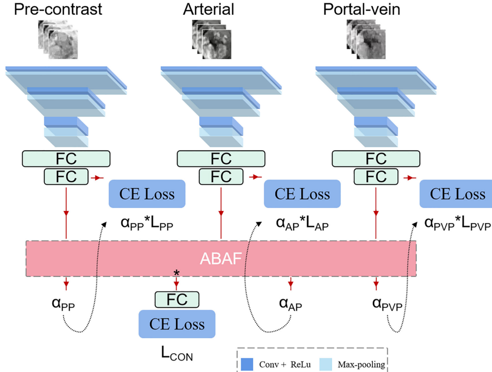 Adaptive Multimodal Fusion With Attention Guided Deep Supervision Net for Grading Hepatocellular ...