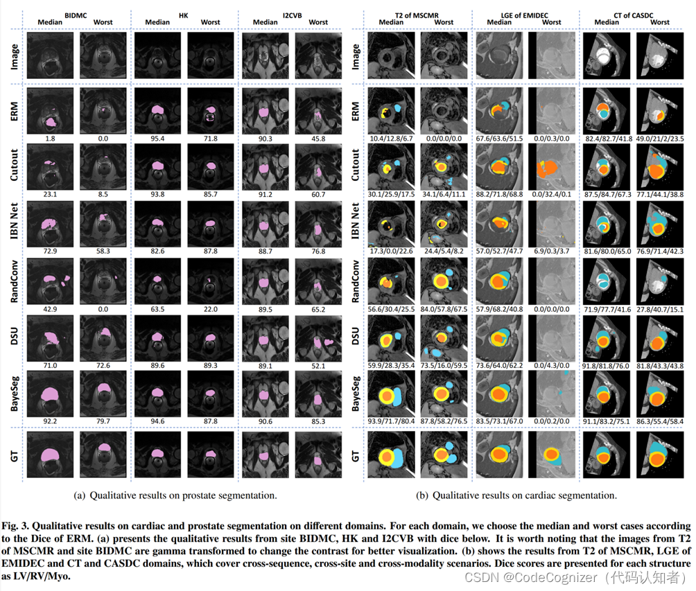 MIA | BayeSeg: Bayesian Modeling for Medical Image Segmentation with Interpretable ...