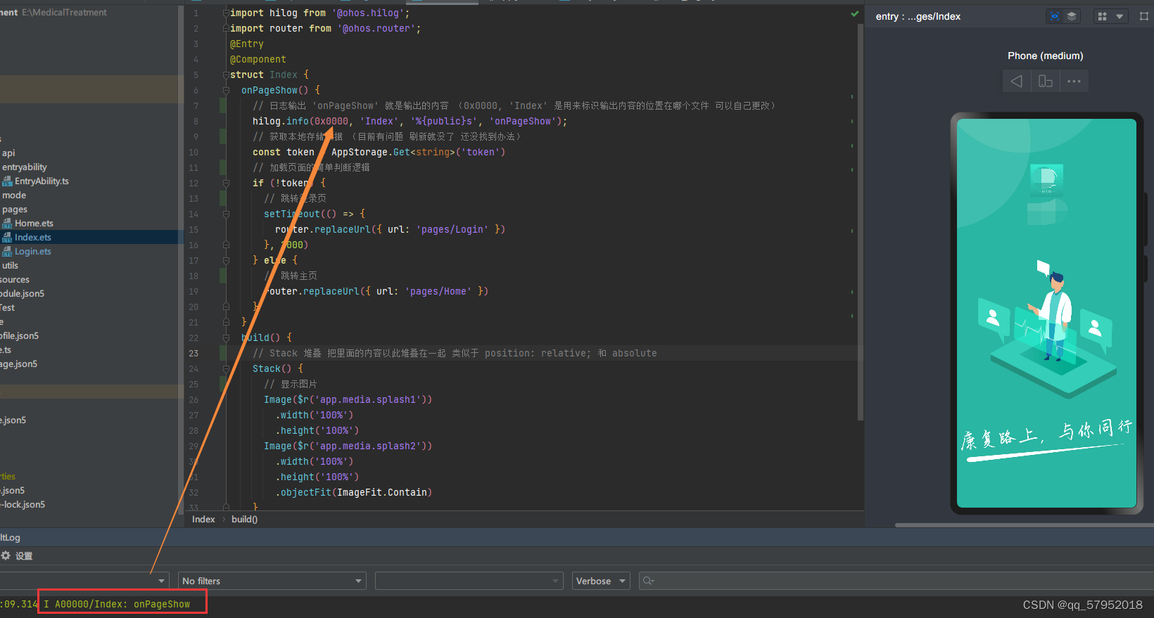 HarmonyOS初体验-CSDN博客
