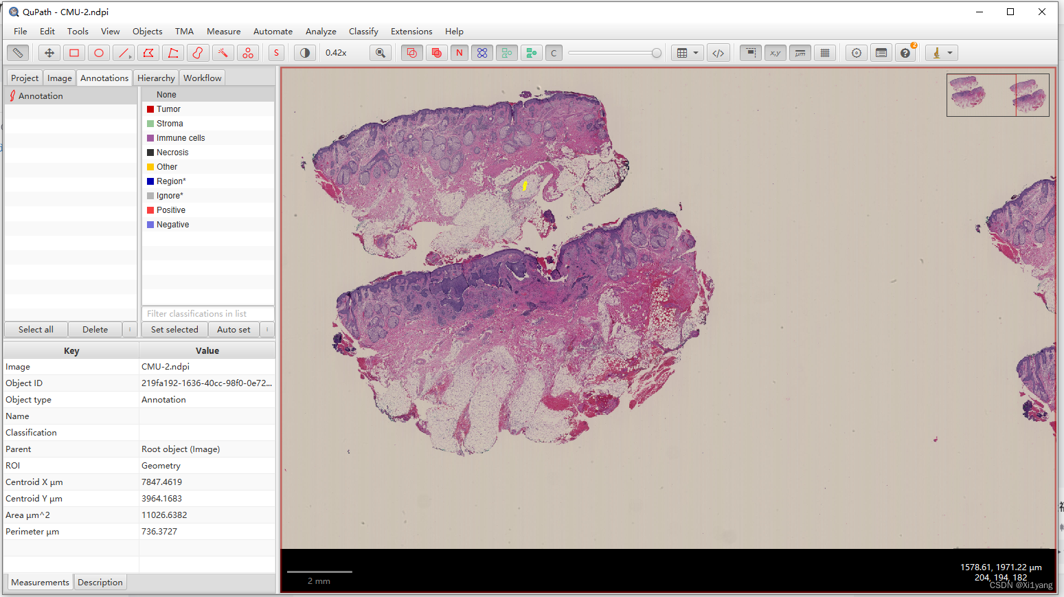 QuPath从源头构建实例_qupath下载-CSDN博客