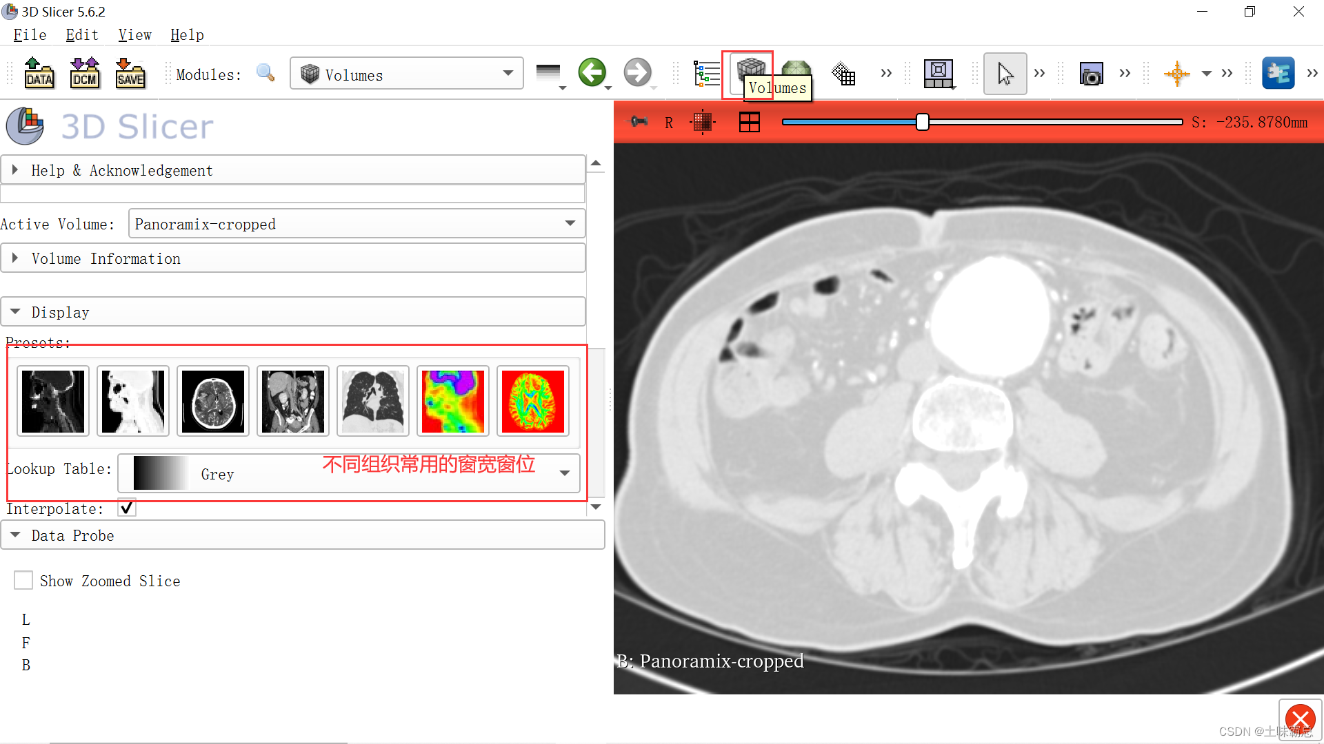 3D Slicer的学习（一）（Win10环境）_设置3d slicer python环境设置-CSDN博客
