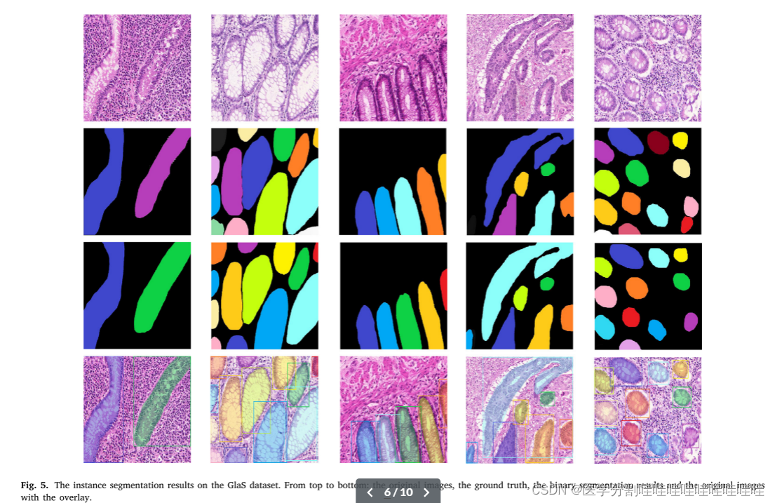 Enhancing gland segmentation in colon histology images using aninstance-aware diffusion model-CSDN博客