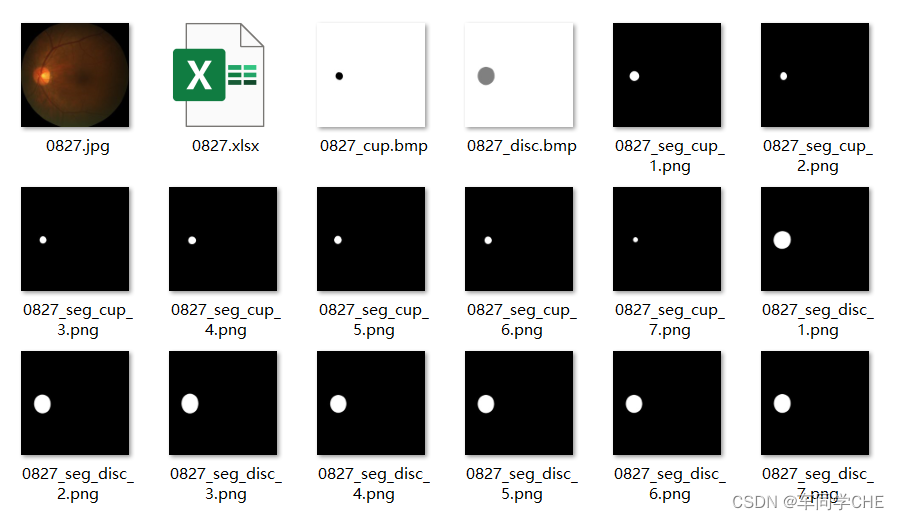 论文代码复现之Medical SAM Adapter (Junde Wu version)_runtimeerror(f"applying ...
