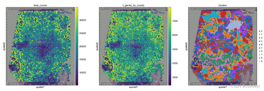 scanpy单细胞分析官网示例全解析（三）全网最详细及细节_空间转录组 scanpy-CSDN博客