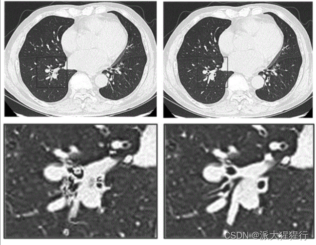 图像处理入门：SR超分辨率——基于深度学习_vdsr-CSDN博客