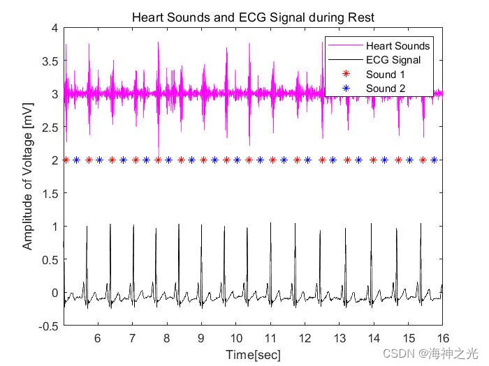 【心电信号ECG】心电信号处理（时域频域滤波 QRS检测 心率检测）【含Matlab源码 4306期】_心电信号处理系统设计-CSDN博客
