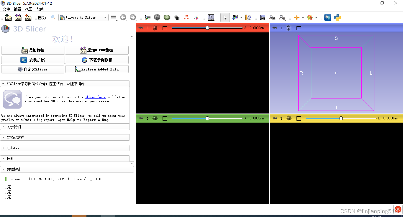 新手自己动手设置3D-slicer中文版（超详细图文）_3dslicer汉化-CSDN博客