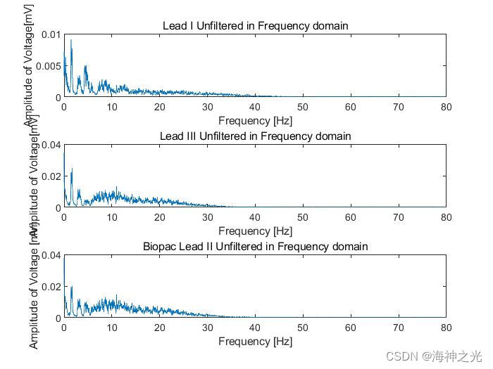 【心电信号ECG】基于matlab心电信号处理（时域频域滤波 QRS检测 心率检测）【含Matlab源码 4306期】_matlab心率数据处理-CSDN博客