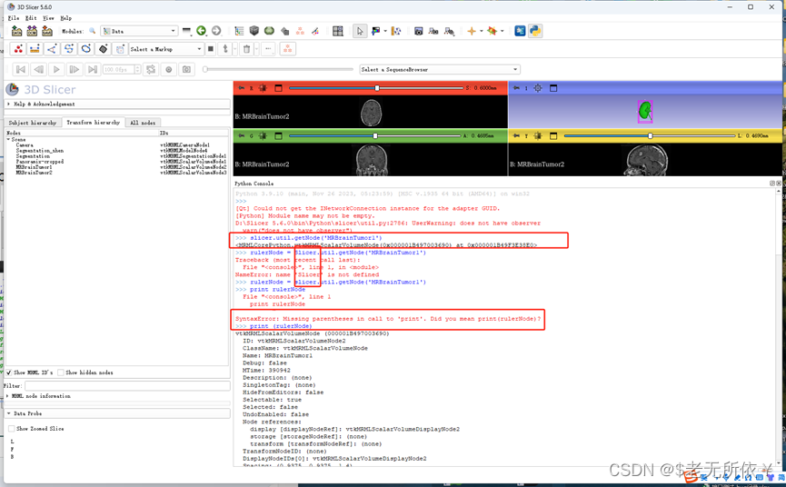 3DSlicer中自己创建一个Extension项目（前篇）_3d slicer拓展-CSDN博客