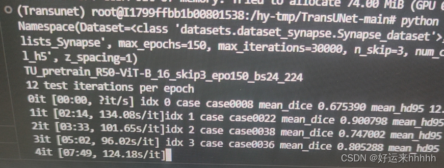 Transunet复现_transunet复现测试出错-CSDN博客