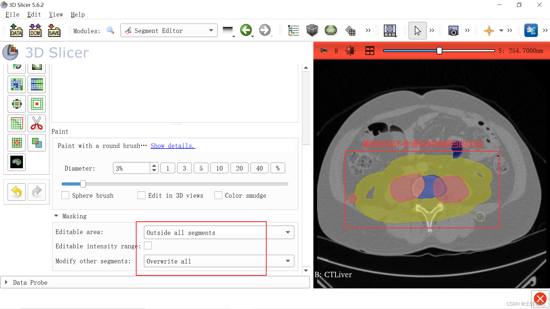 3D Slicer的学习（二） 图像的分割_3dslicer窗宽窗位-CSDN博客