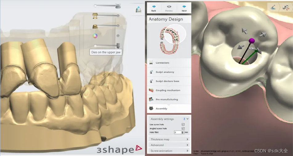 牙科系统CAD:3Shape Dental System Patch-CSDN博客