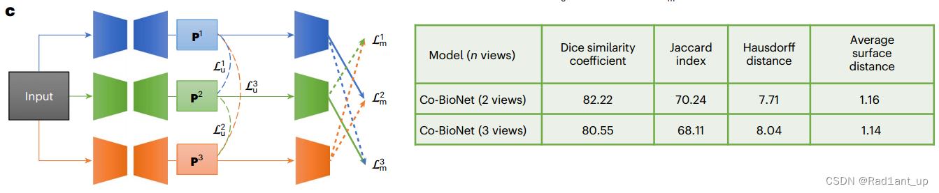 Uncertainty-guided dual-views for semi-supervised volumetric medical image segmentation-CSDN博客