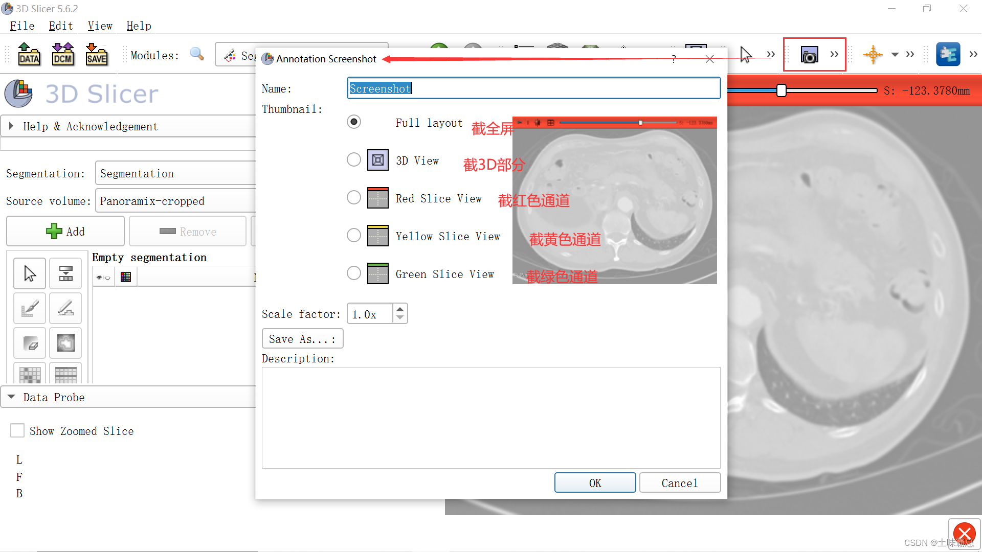 3D Slicer的学习（一）（Win10环境）_设置3d slicer python环境设置-CSDN博客