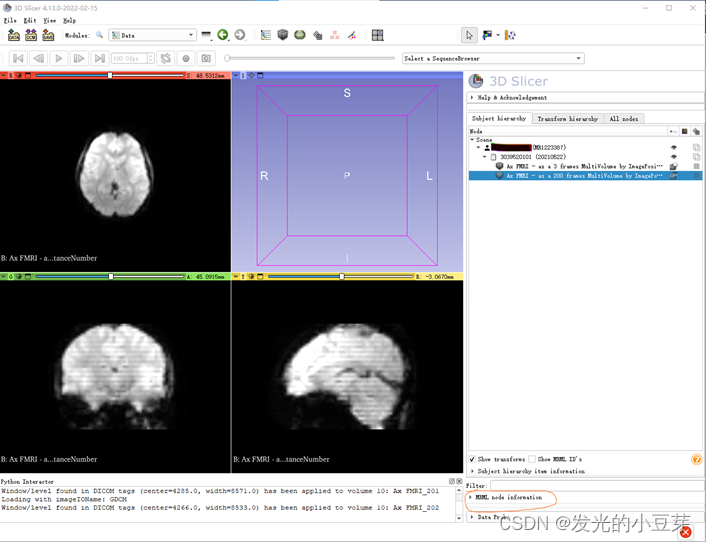 3D Slicer打开 fMRI 影像并查看扫描参数_fmri查看属性-CSDN博客