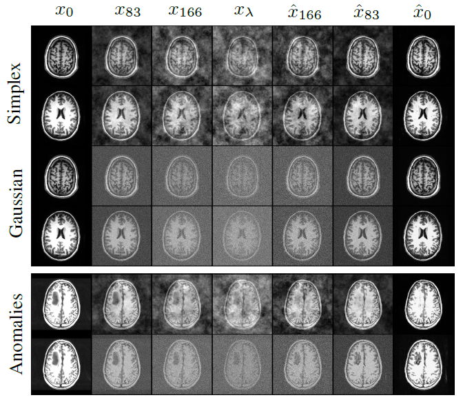 论文阅读 (110)：AnoDDPM: Anomaly detection with denoising diffusion probabilistic models-CSDN博客