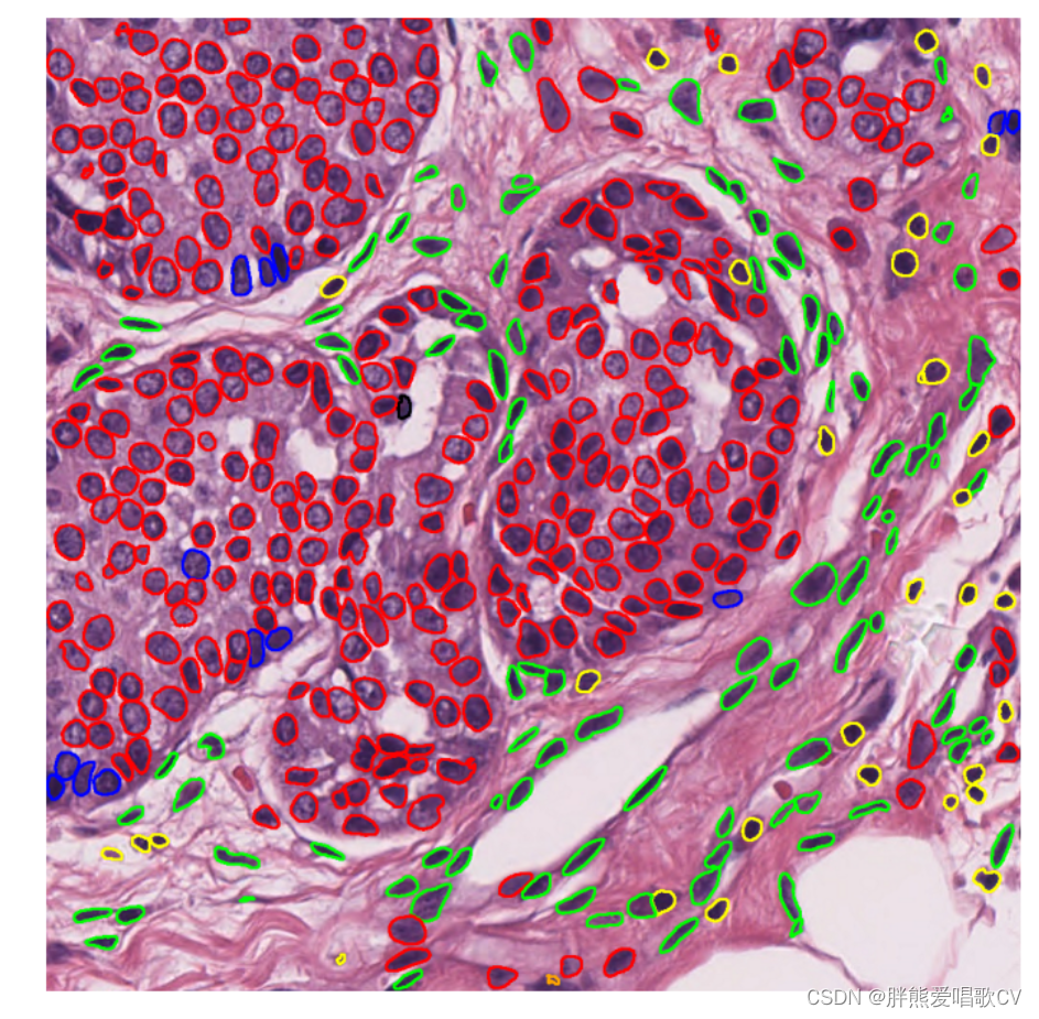 Hovernet代码复现-CSDN博客