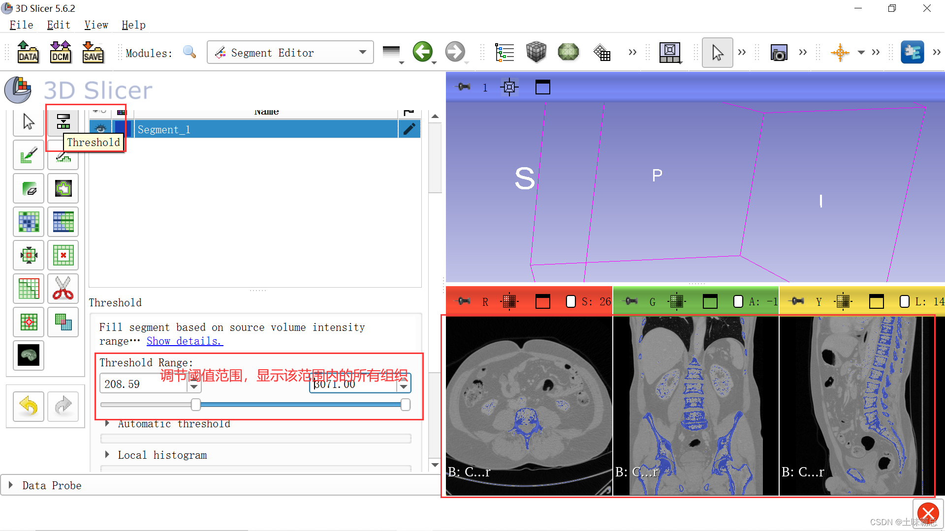 3D Slicer的学习（二） 图像的分割_3dslicer裁剪-CSDN博客