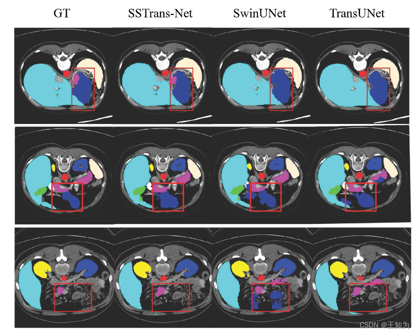 SSTrans-Net: Smart Swin Transformer Network for medical image segmentation-CSDN博客