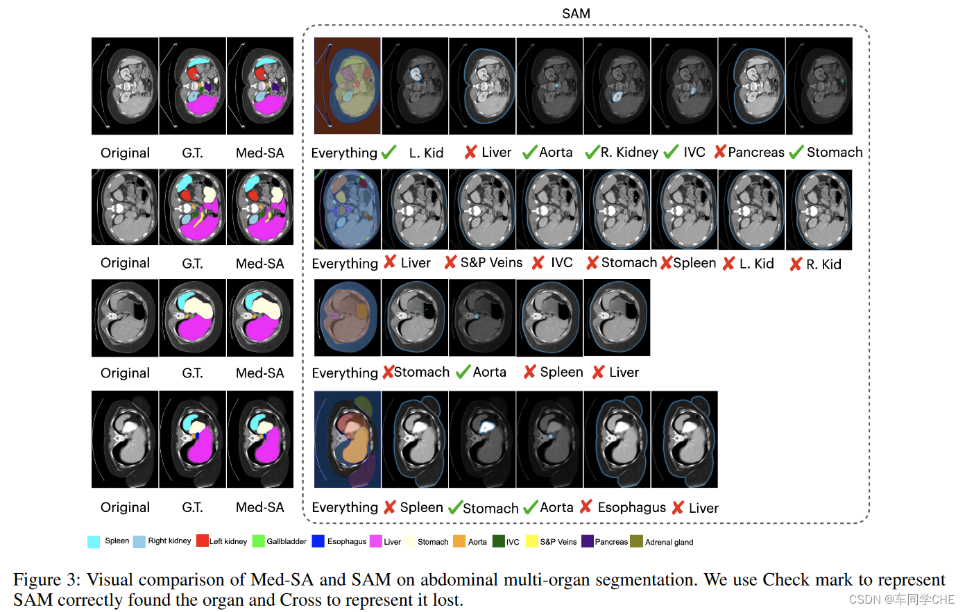论文代码复现之Medical SAM Adapter (Junde Wu version)_runtimeerror(f"applying ...