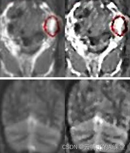 医学图像增强-CSDN博客